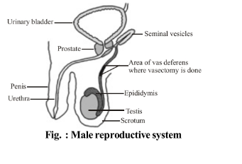 Draw a labelled diagram of male reproductive system.