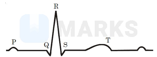 Given below is the ECG of a normal human. Which one of its components ...