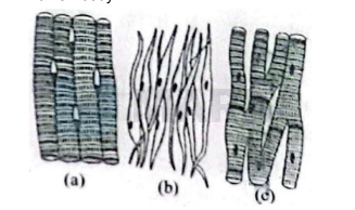 Three types of muscles are given as a , b and c . Identify the correct ...